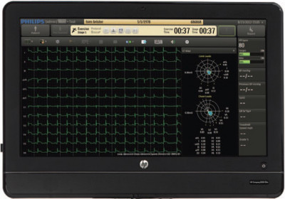 Philips ST80i Stress Test System from $1,700.00/mo