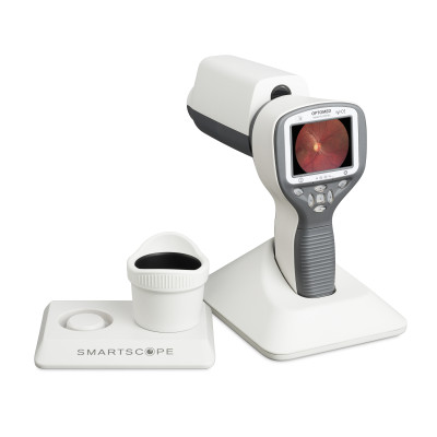 Optomed Smartscope PRO Retinal / Fundus Camera | Rent, Finance, or Buy